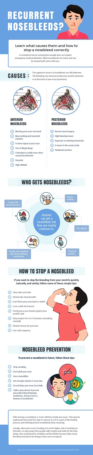 Nosebleed? Don’t Worry – Here’s How to Cure It | Latest Infographics